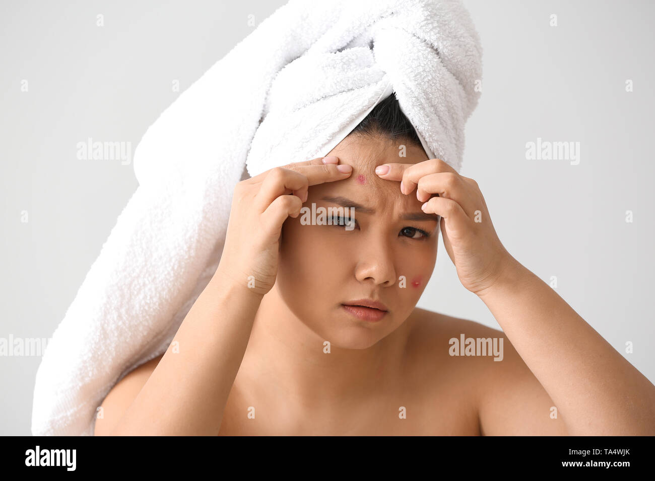 Portrait Of Young Asian Woman With Acne Problem Squishing Pimples On