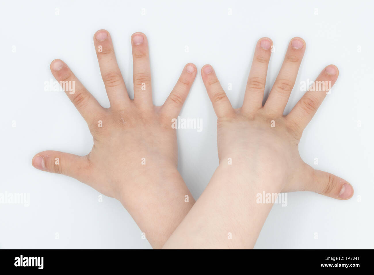 Young childs body hi-res stock photography and images - Alamy