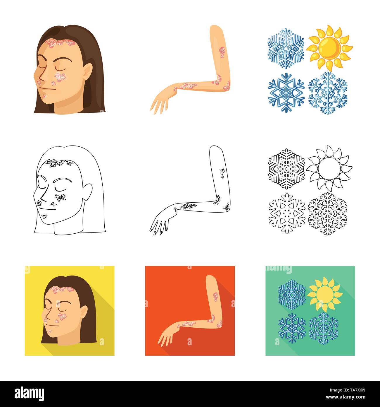 Skin rash sun allergy hi-res stock photography and images - Alamy