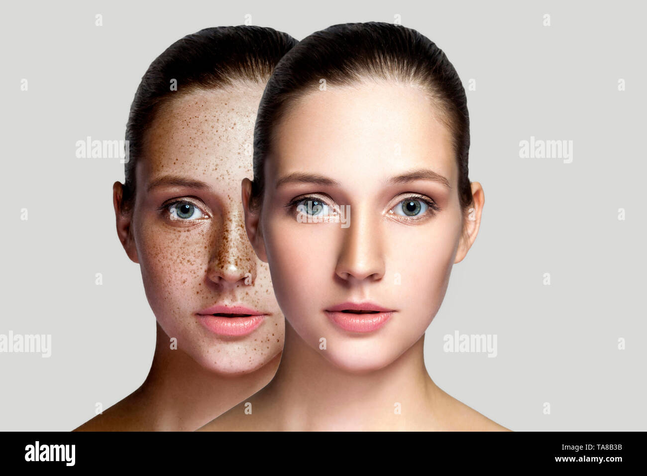 Freckles brunette hi-res stock photography and images - Alamy