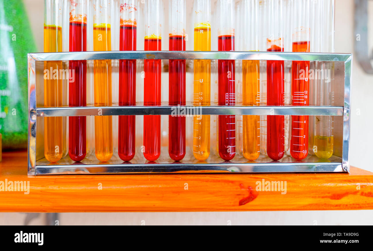 Various Colored Blood Test Tubes Stock Photo Alamy various-colored-blood-test-tubes-stock-photo-alamy