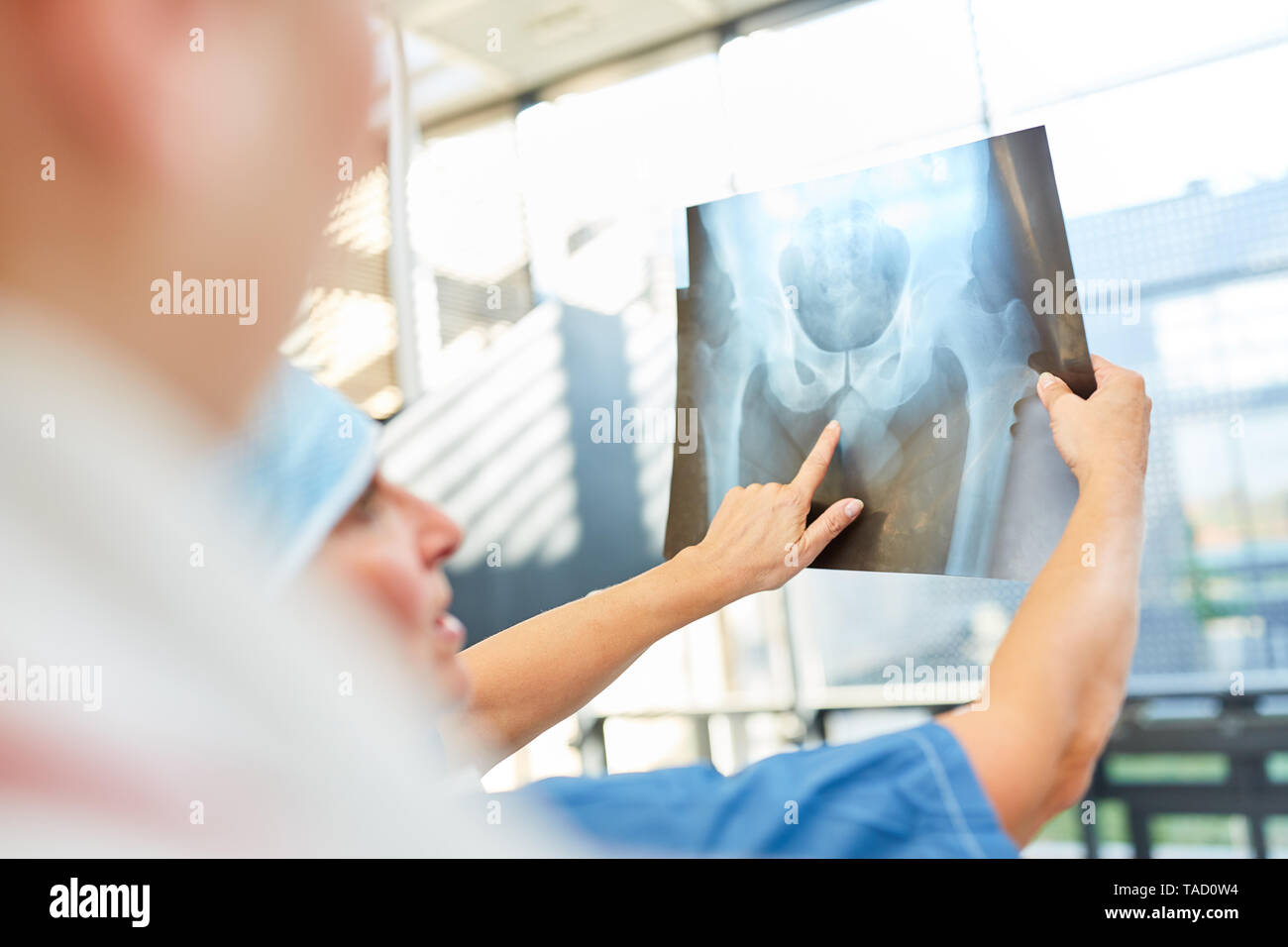 Radiologist points to the findings on the radiograph in X-ray ...