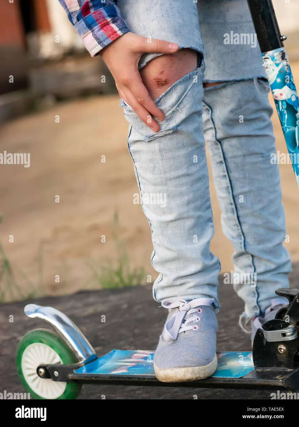 the girl fell off the scooter and hurt her leg Stock Photo - Alamy