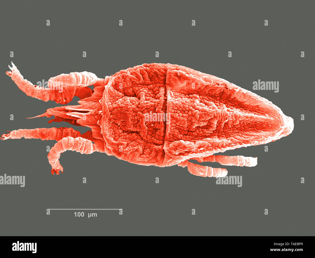 Scanning Electron Microscopy Stock Photos & Scanning Electron ...