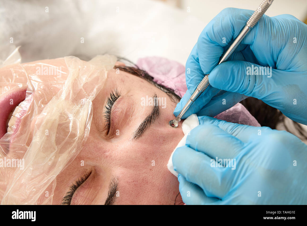 Young woman in beauty salon does manual face cleaning. Manual removal ...