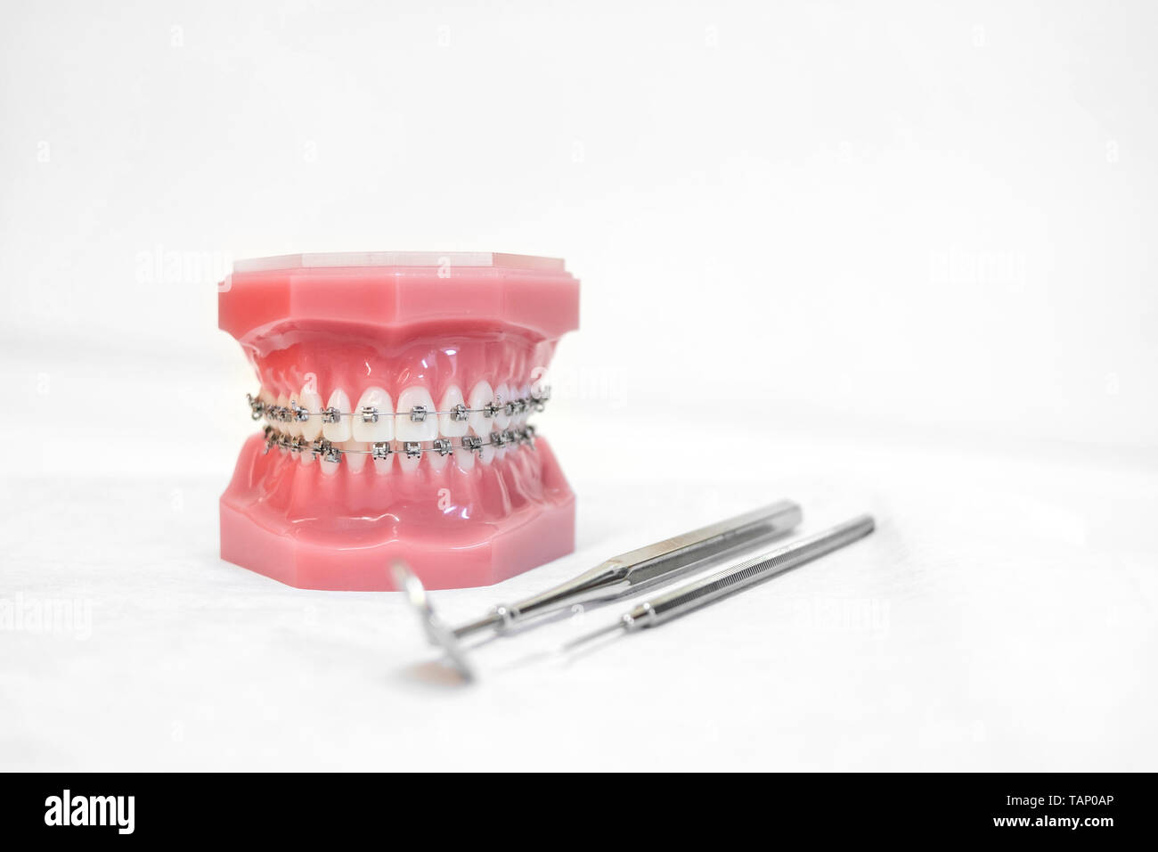 dental model with braces - Teeth orthodontic dental model with dental ...