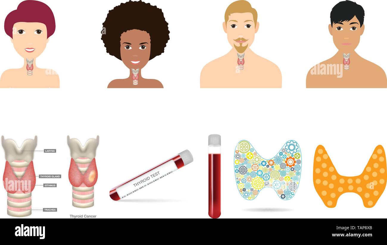 Thyroid gland on a silhouette of a men and women. Big thyroid elements ...