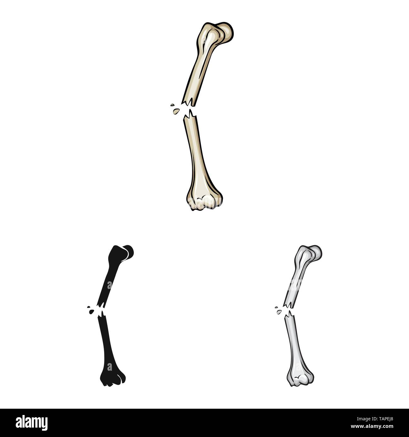 fracture,pain,bias,injury,connective,musculoskeletal,fiber,scientific ...