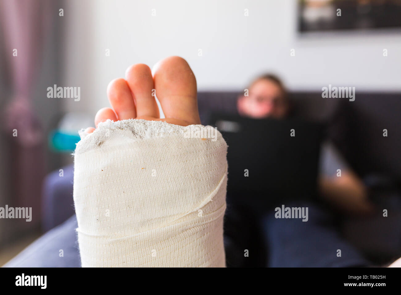 Plaster Leg Cast Legs Stock Photos & Plaster Leg Cast Legs Stock Images ...