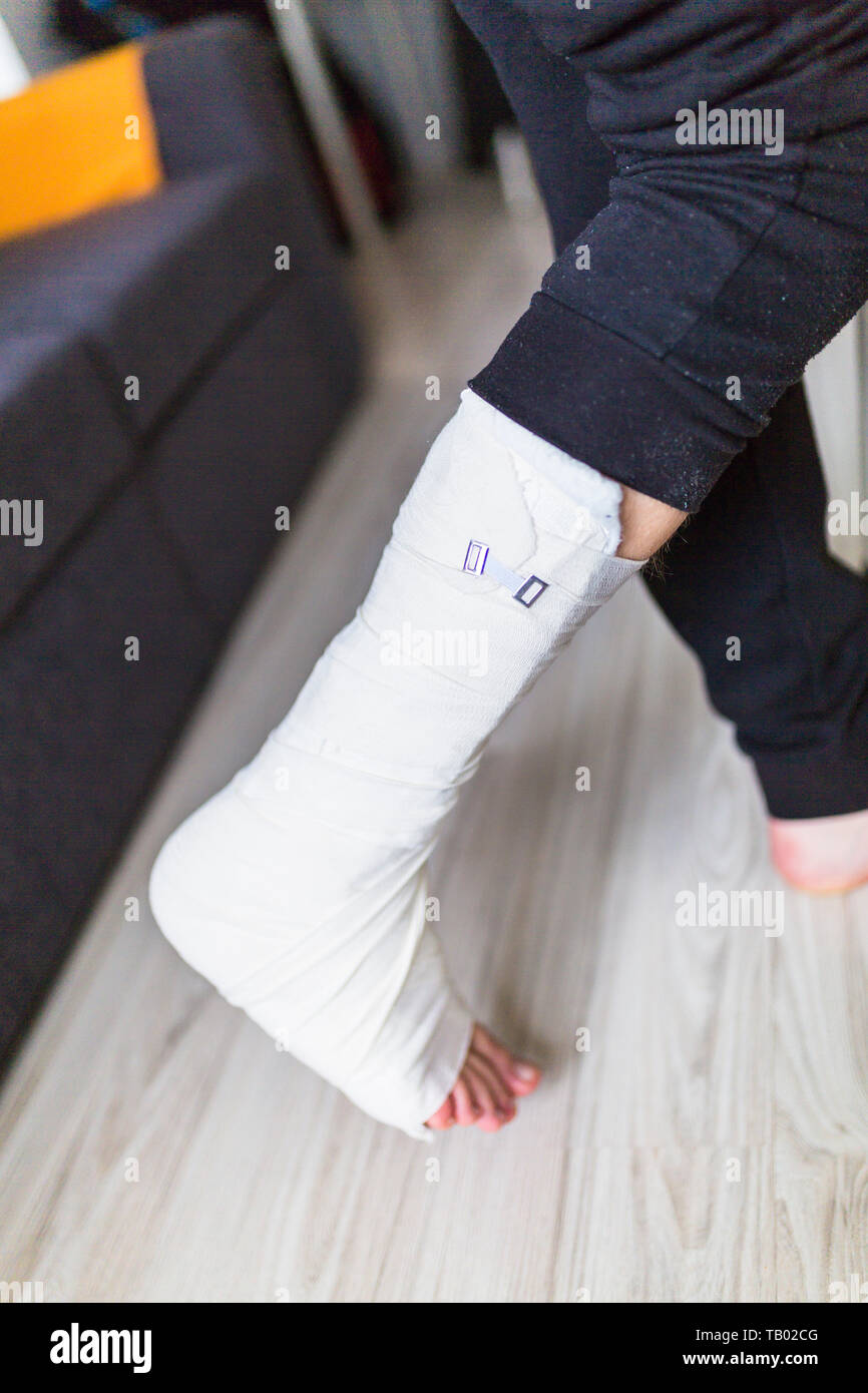 The man is trying to walk with a broken leg Stock Photo - Alamy