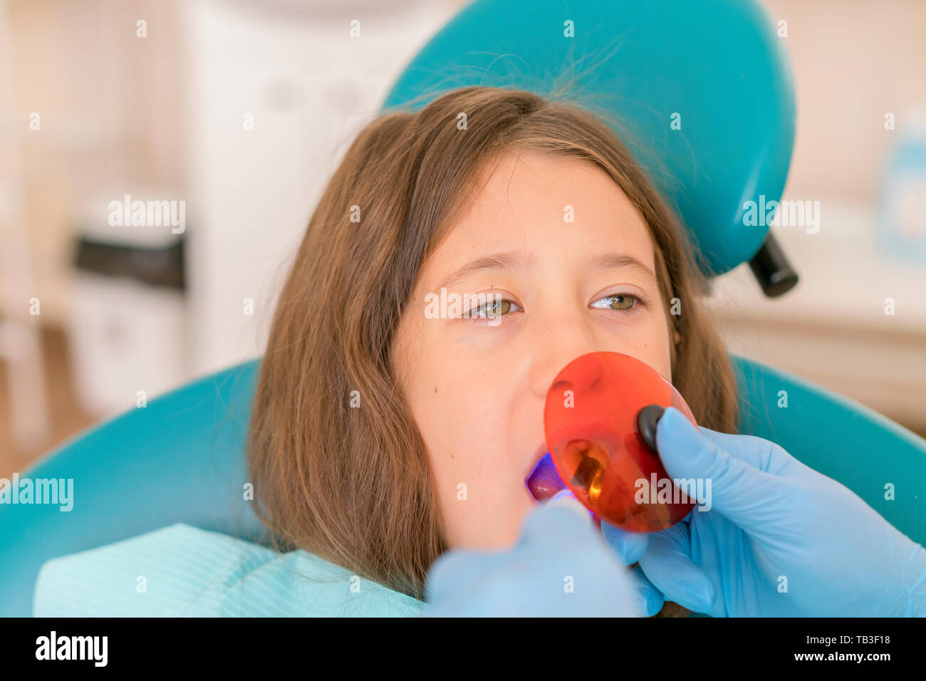 girl getting dental filling treatment at molar tooth with ultraviolet ...