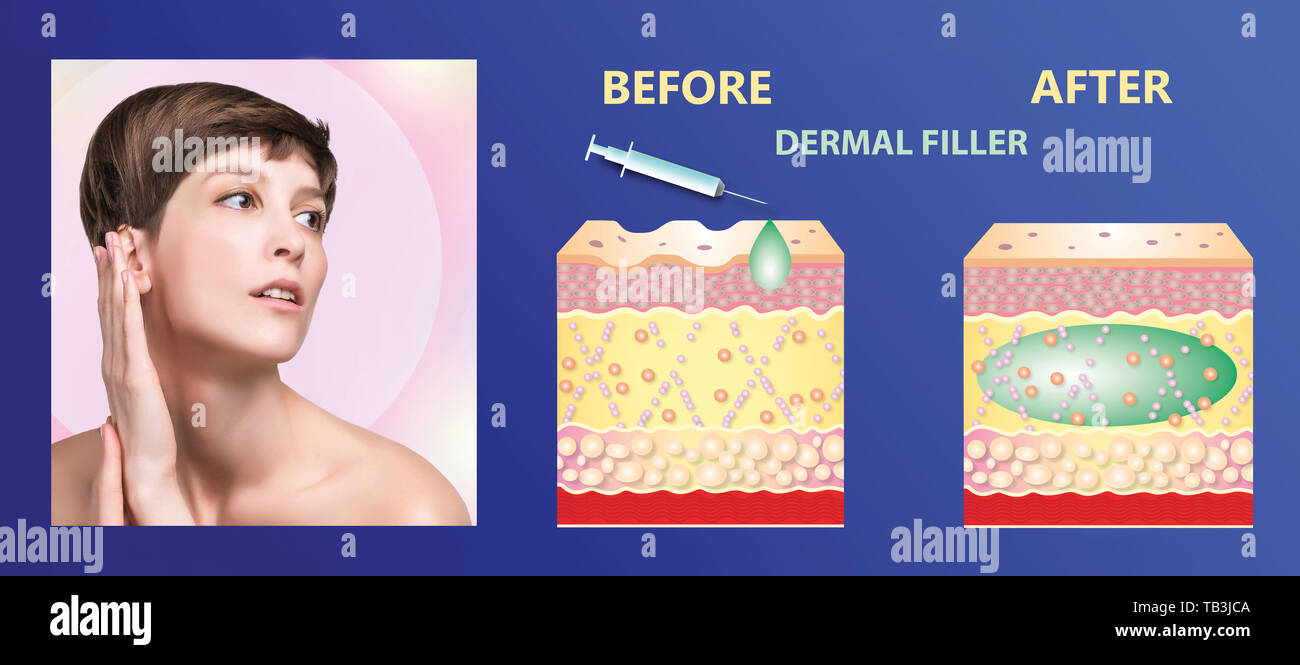 Fillers anatomy hi-res stock photography and images - Alamy