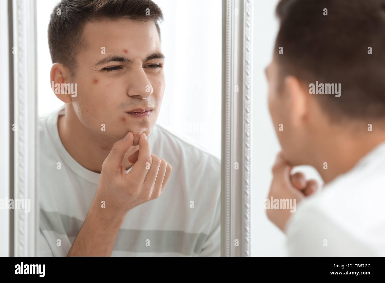 Portrait of young man with acne problem looking in mirror at home Stock ...