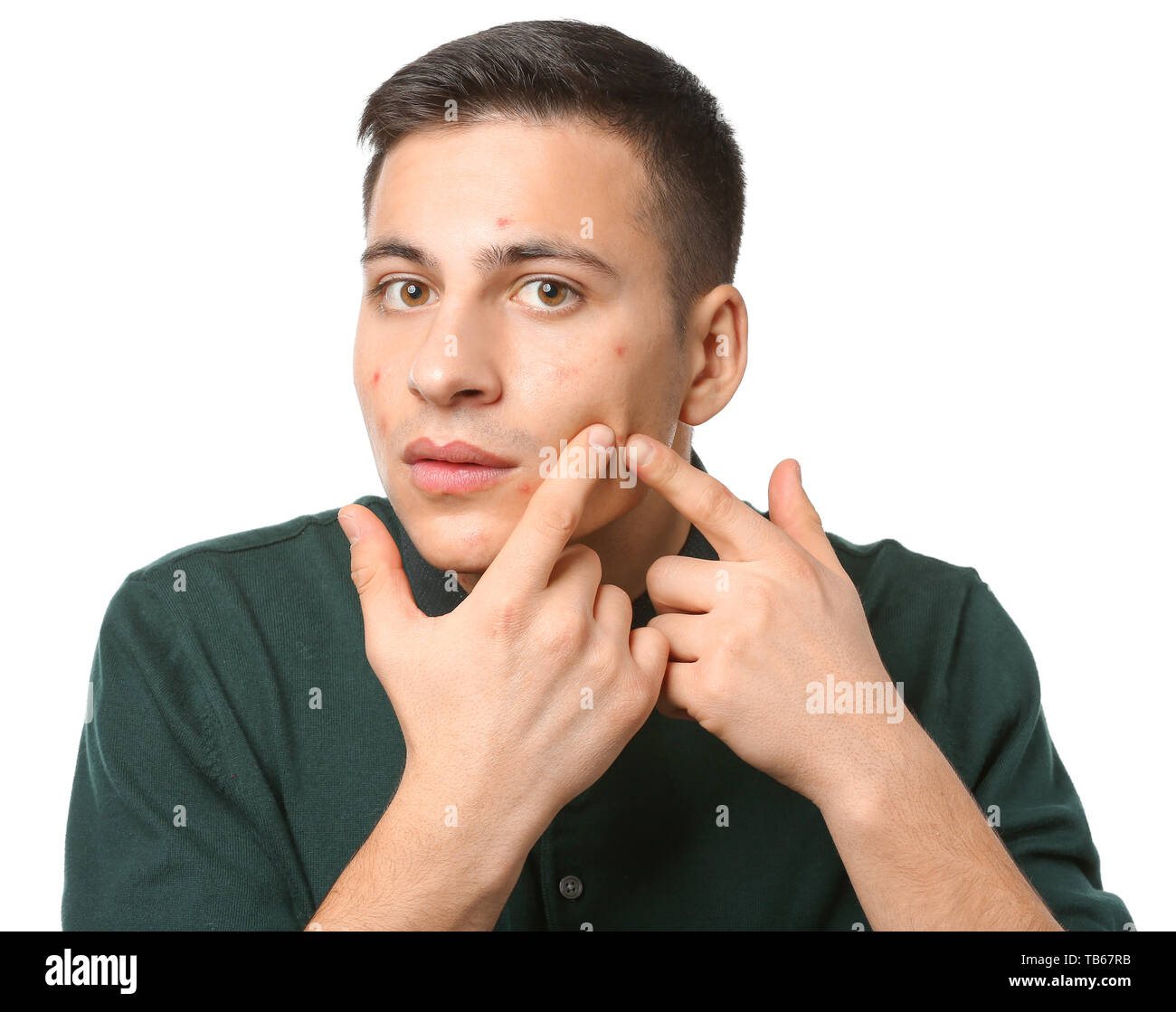 Portrait of young man with acne problem squishing pimples on white ...