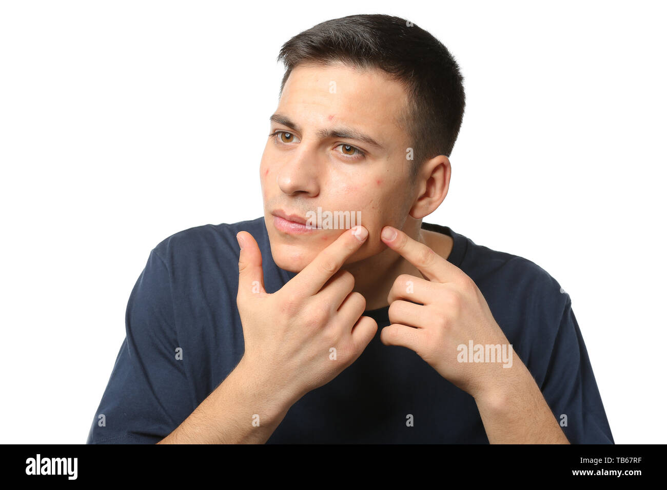 Portrait of young man with acne problem squishing pimples on white ...