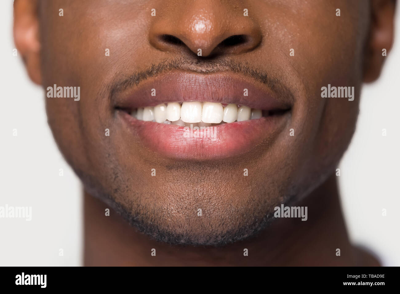 Teeth veneers repair hi-res stock photography and images - Alamy