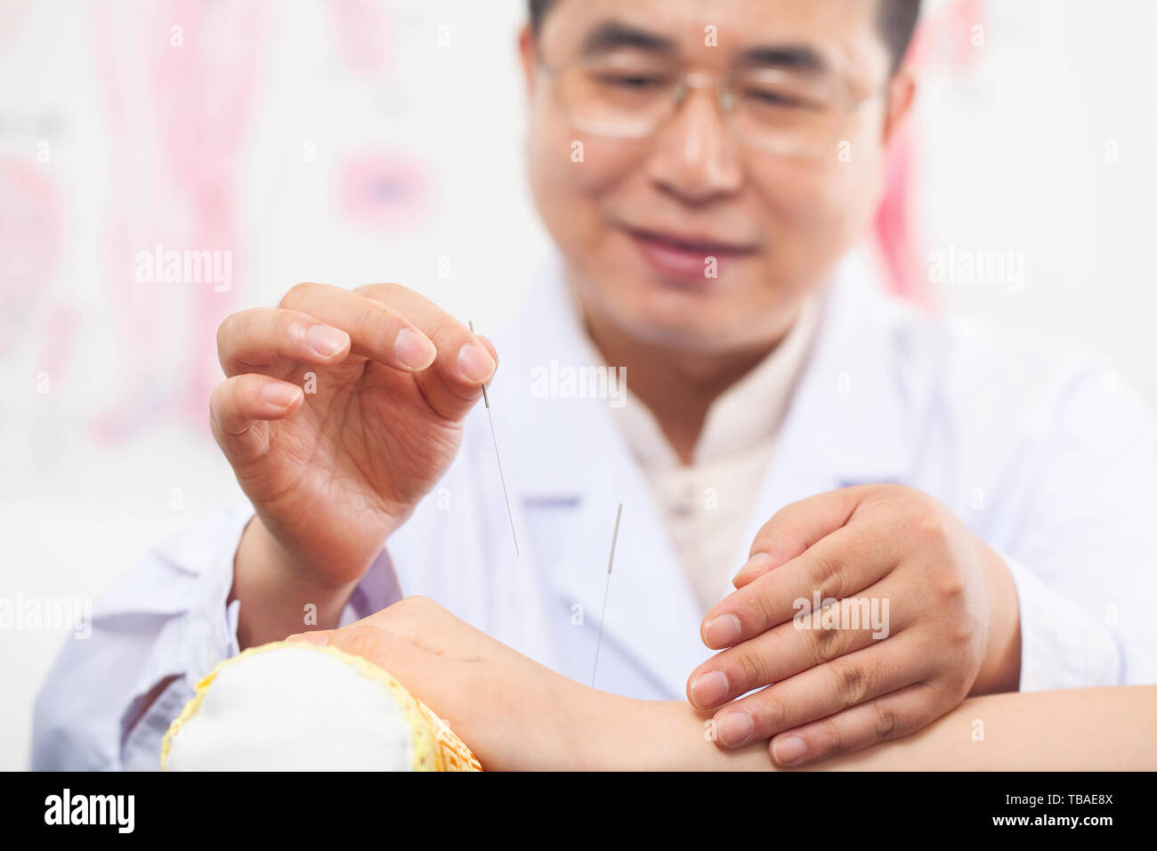 Acupuncture tradition hi-res stock photography and images - Alamy