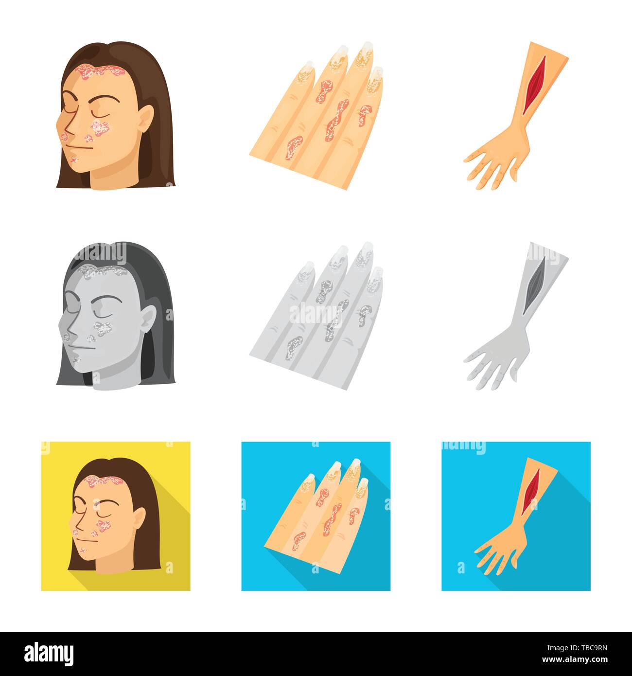 Chronic wound illustration hi-res stock photography and images - Alamy