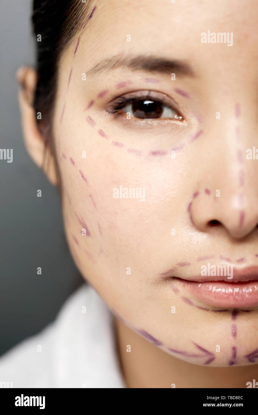 Female cosmetic surgery Stock Photo - Alamy