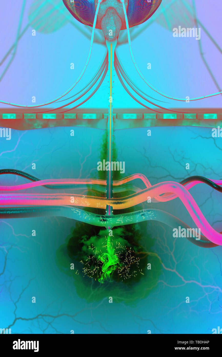 Malaria transmission, illustration. A malaria-infected mosquito ...