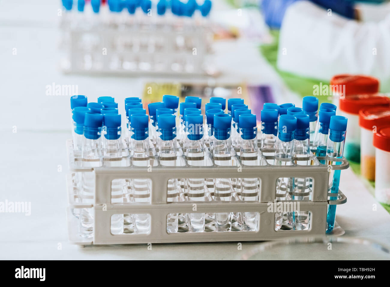 Many test tubes with blue plugs in a rack full of scientific ...