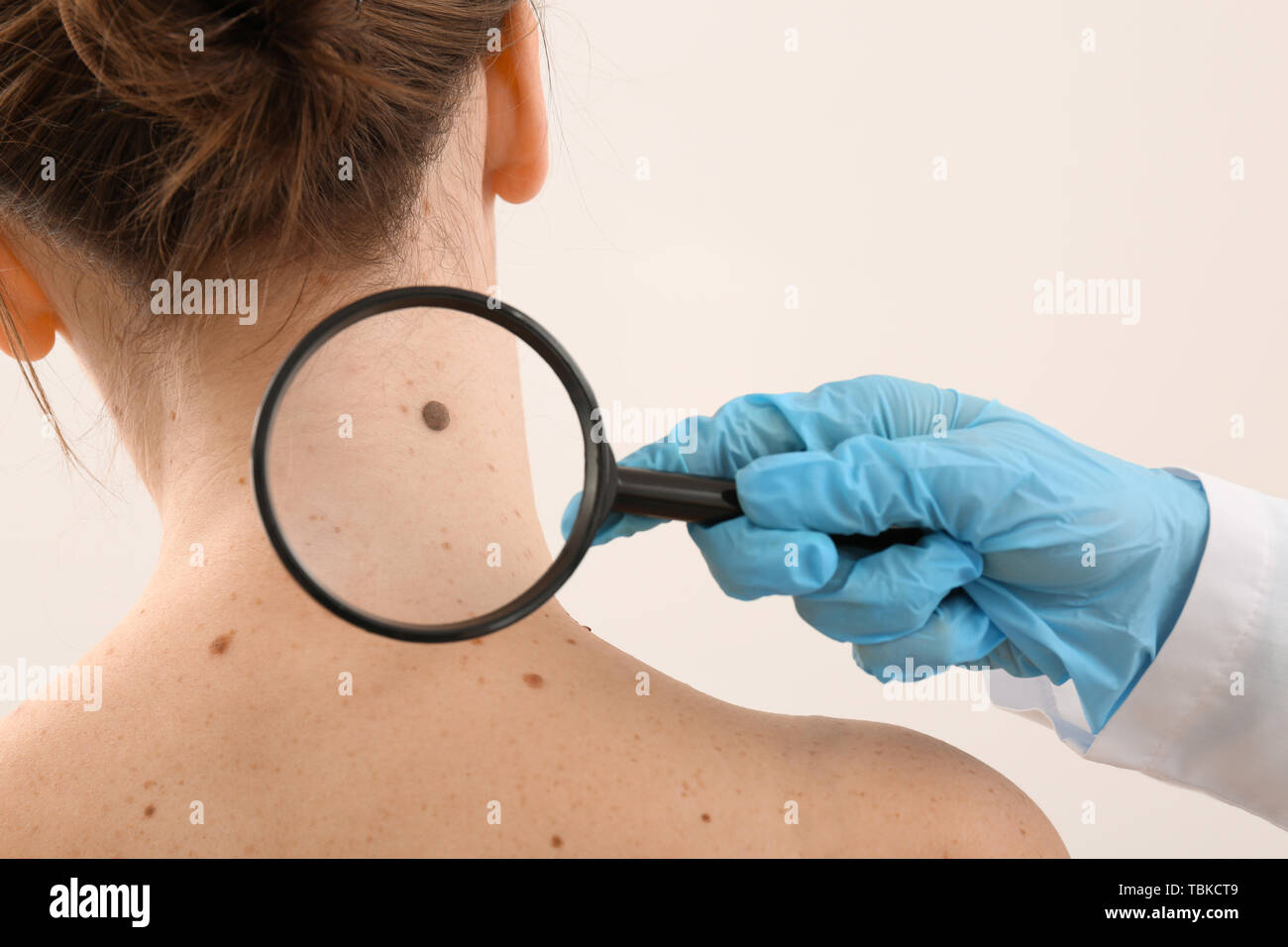 Dermatologist examining moles young hi-res stock photography and images ...