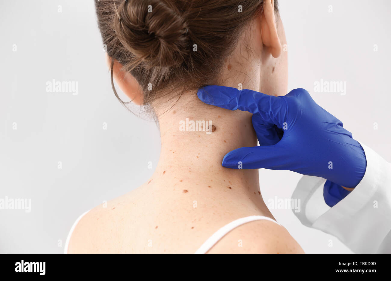 Dermatologist examining moles young hi-res stock photography and images ...