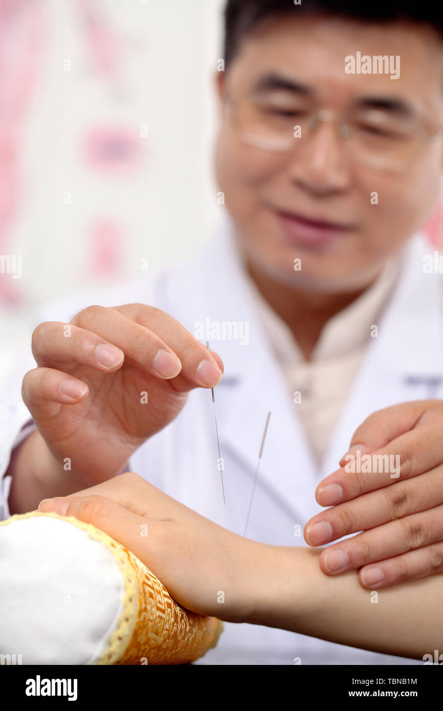 Acupuncture drawing hi-res stock photography and images - Alamy