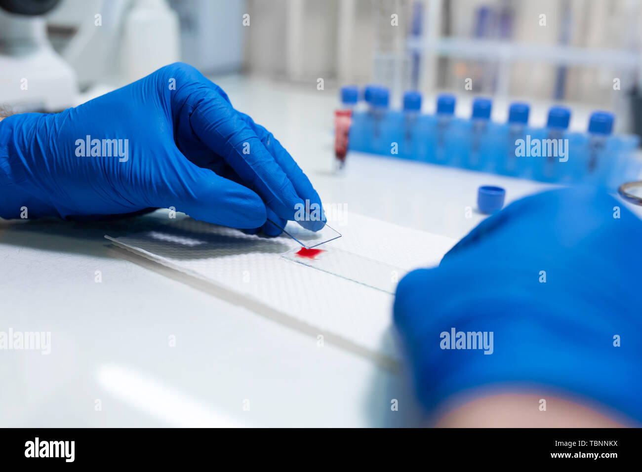 scientist prepare blood sample for research on microscope. Placing ...