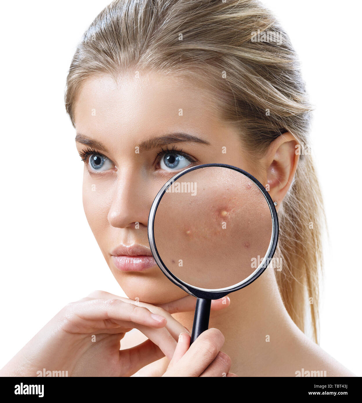 Magnifying glass skin hi-res stock photography and images - Alamy