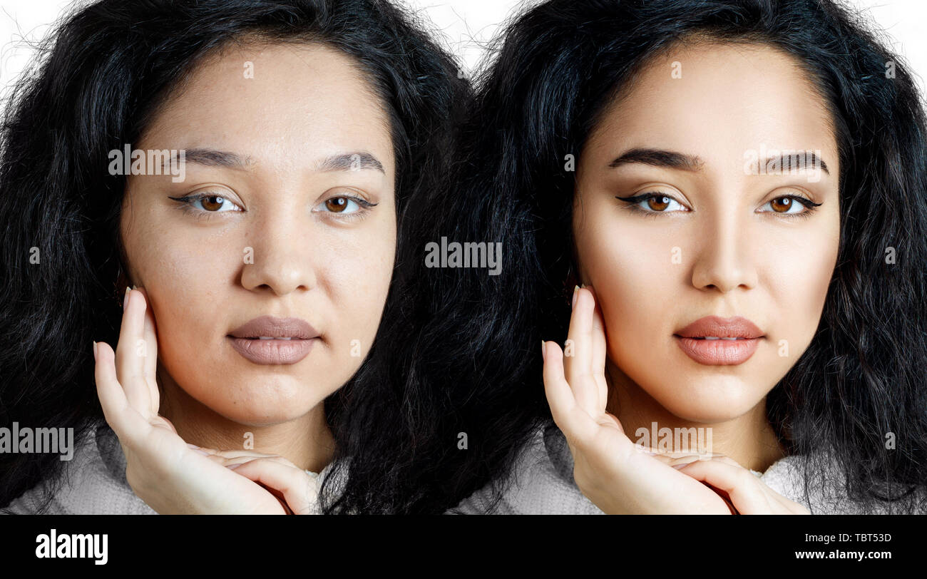 Young girl with problem skin before and after retouch Stock Photo - Alamy