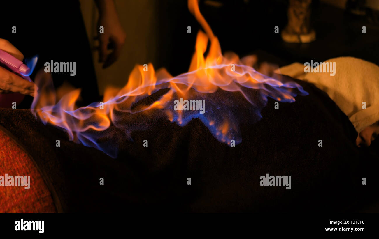 Chinese fire massage and therapy Stock Photo - Alamy
