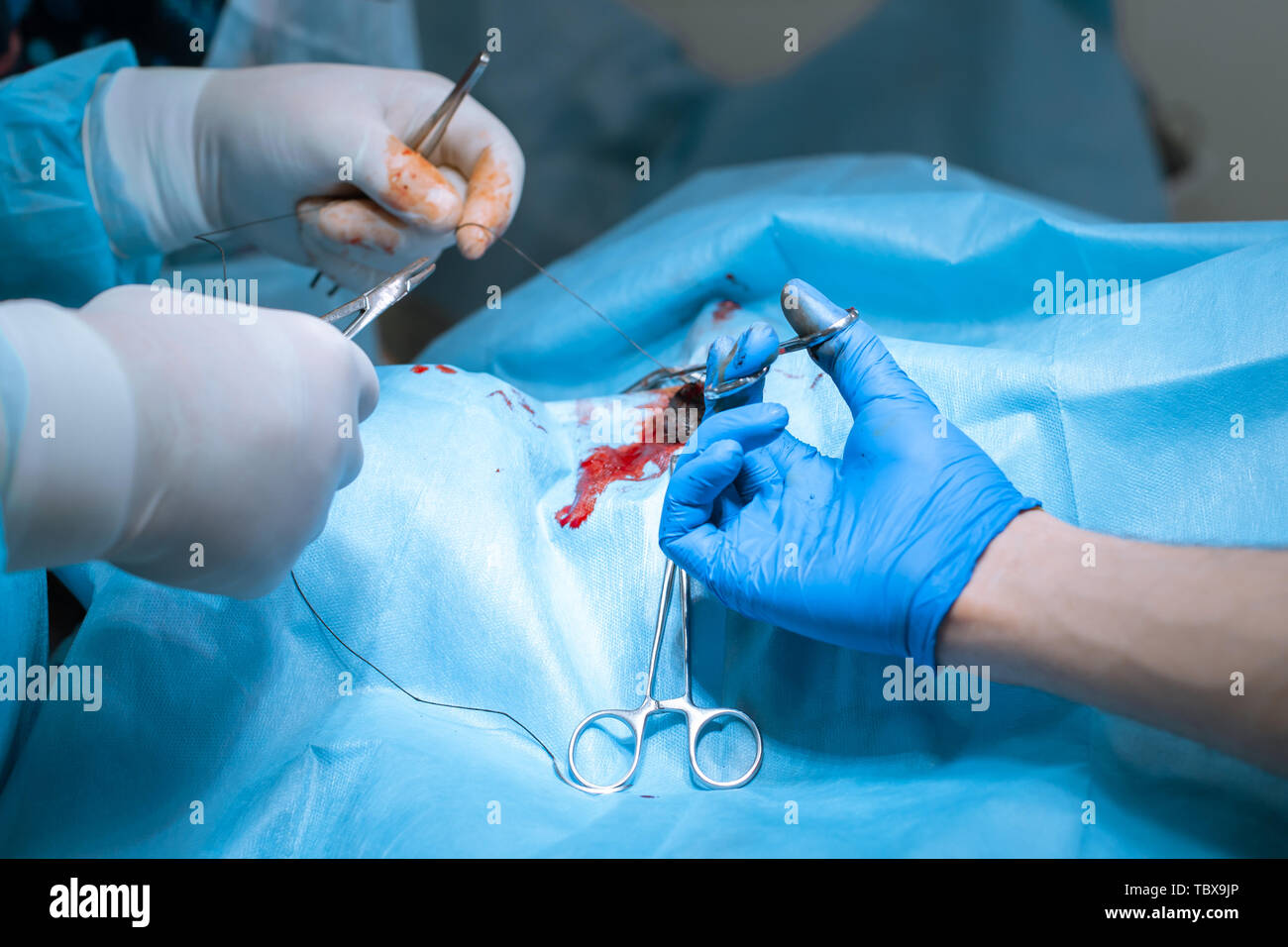 Bleeding clamp hi-res stock photography and images - Alamy