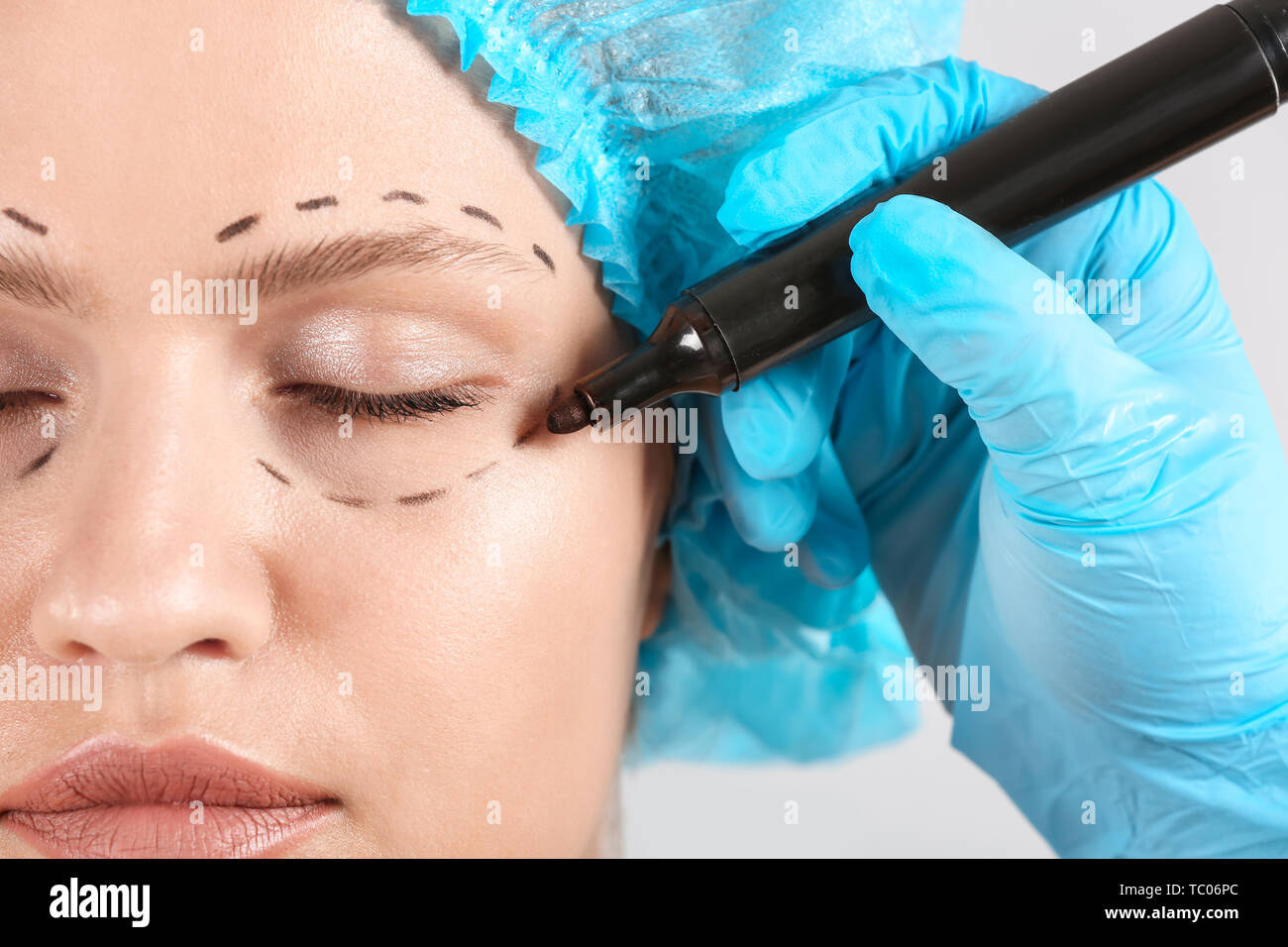 Plastic surgeon applying marking on female face, closeup Stock Photo ...