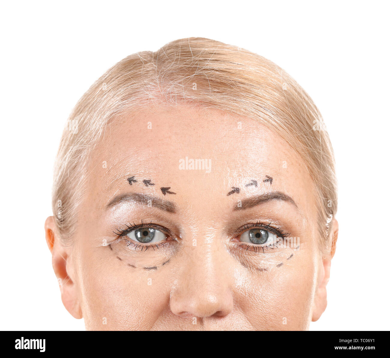 Mature woman with marks on her face against white background, closeup ...
