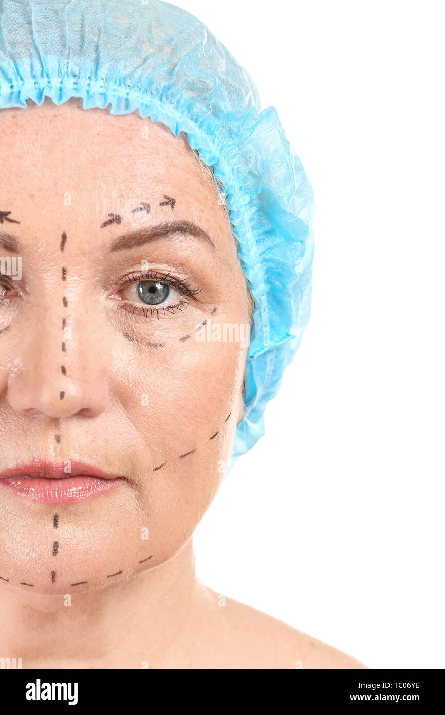 Mature woman with marks on her face against white background, closeup ...
