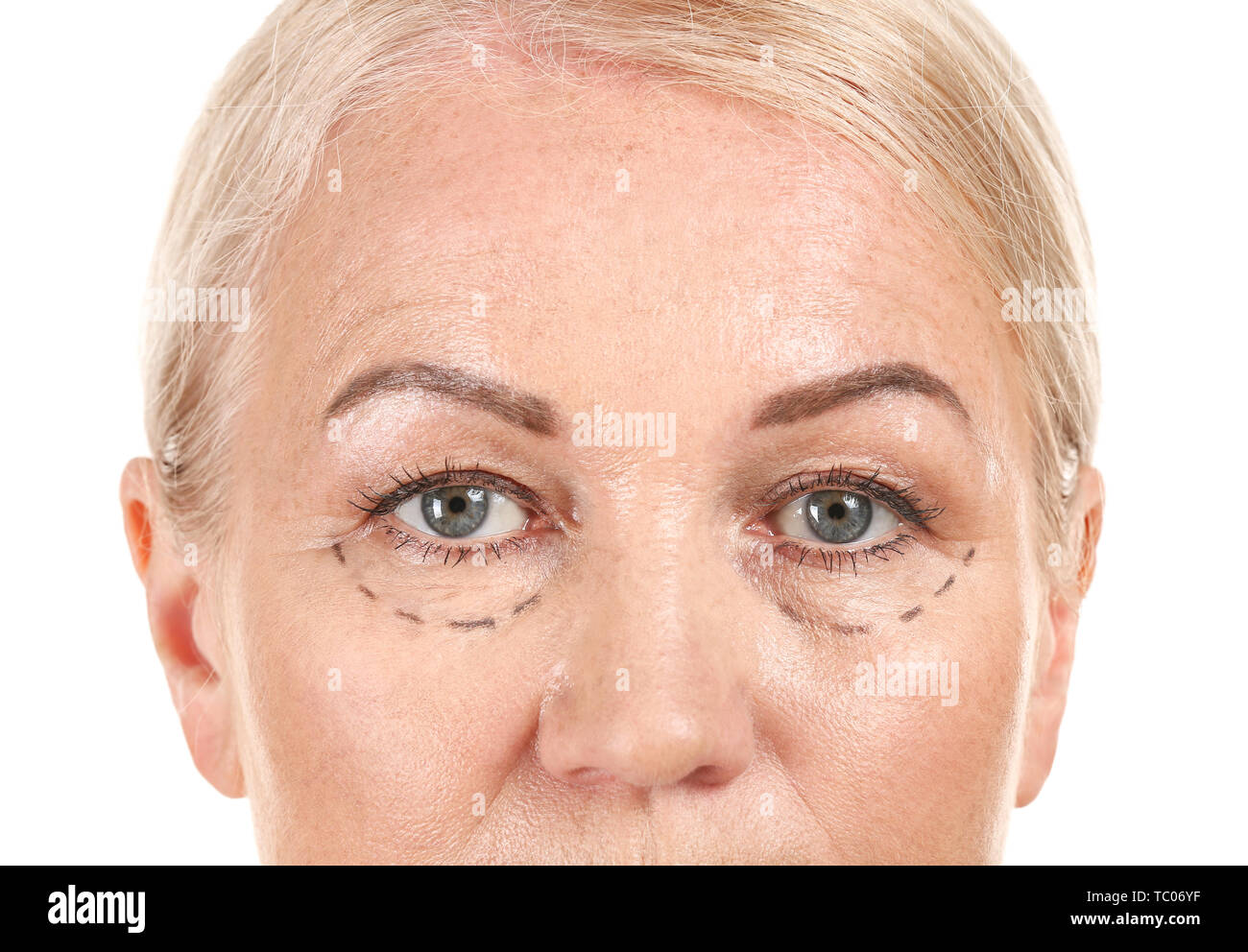 Mature woman with marks on her face against white background, closeup ...