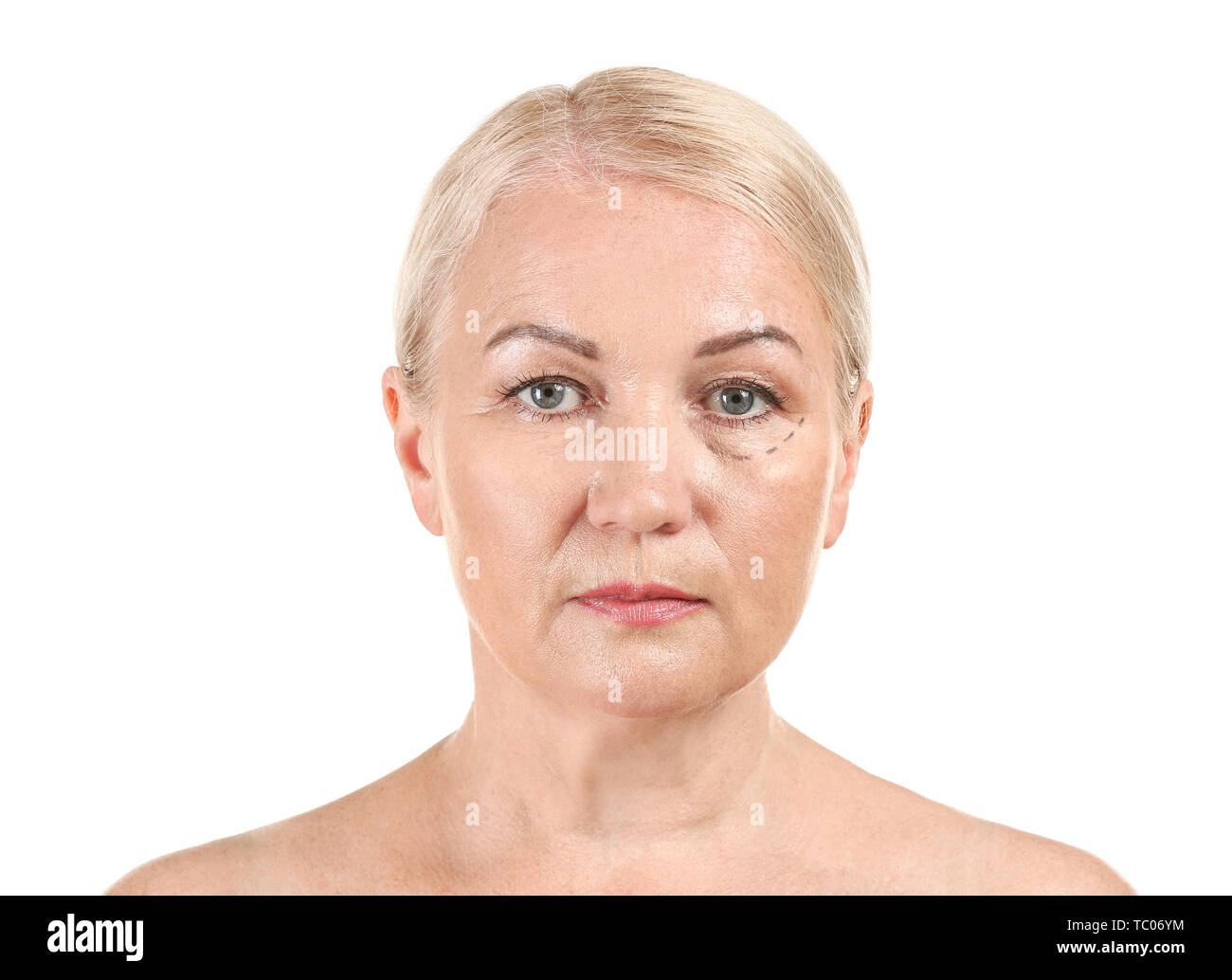 Mature woman with marks on her face against white background. Concept ...