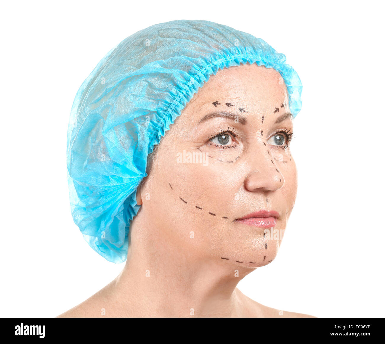 Mature woman with marks on her face against white background. Concept ...