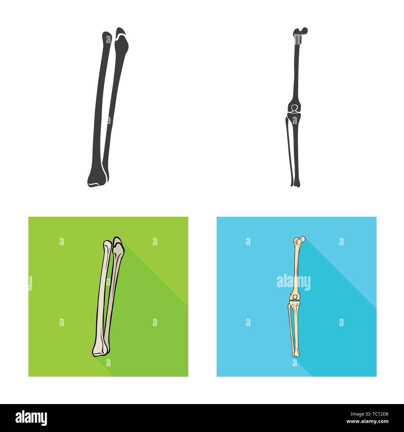 femur,knee,joint,leg,meniscus,body,tibia,foot,fibula,alignment,surgery ...