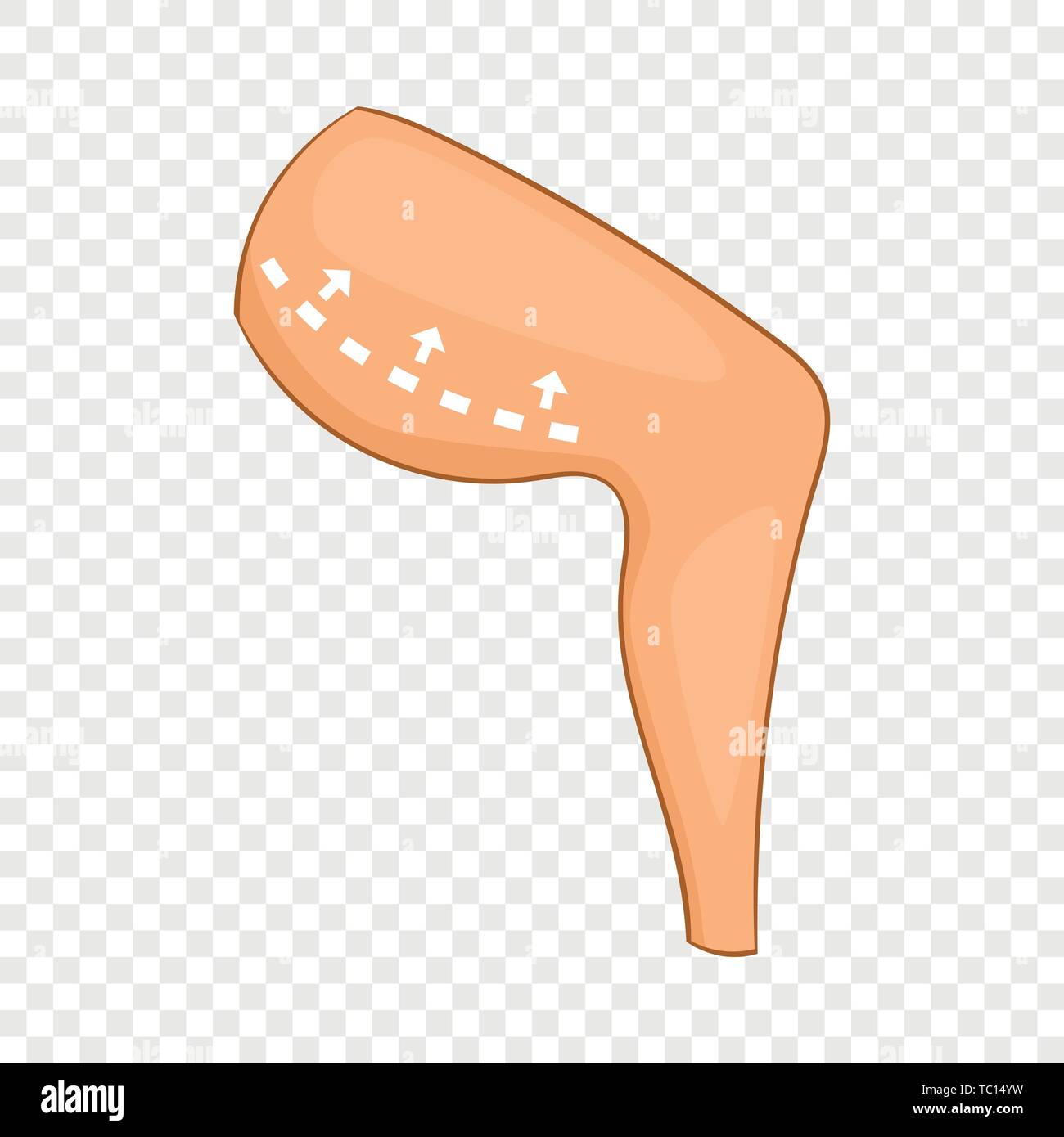 Thigh surgery correction icon, cartoon style Stock Vector Image & Art ...