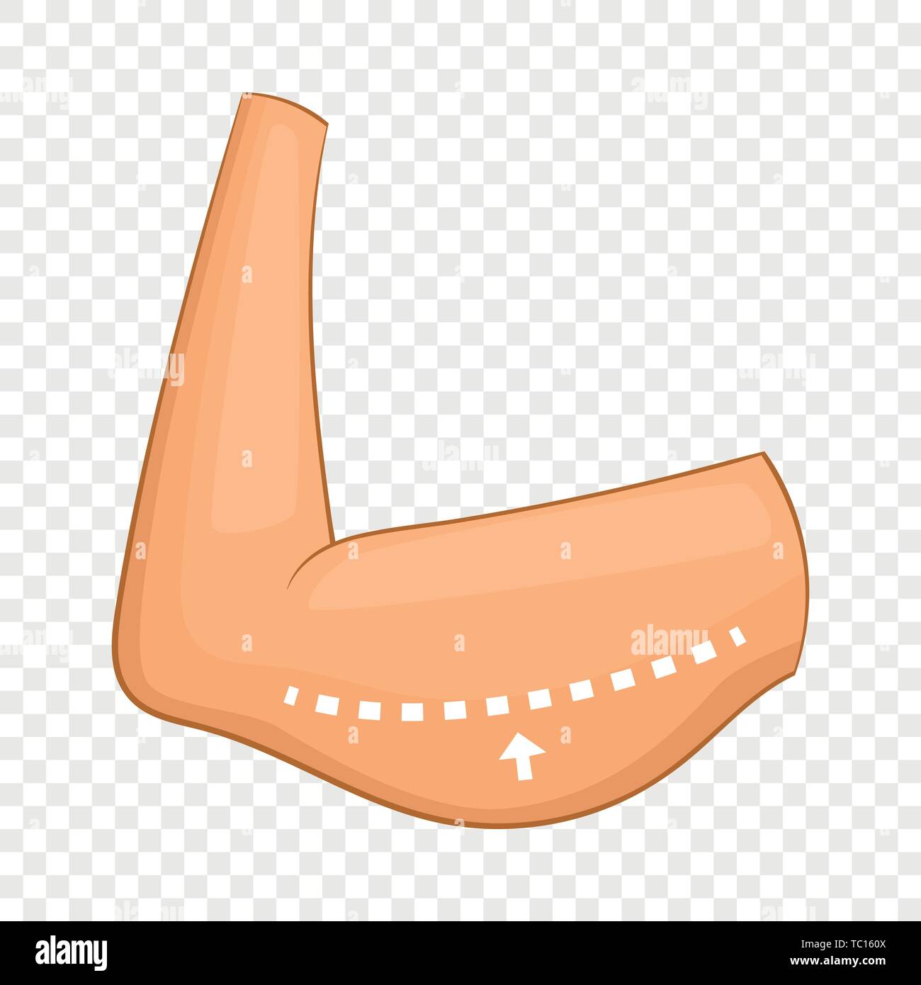 Upper arm surgery correction icon, cartoon style Stock Vector Image ...