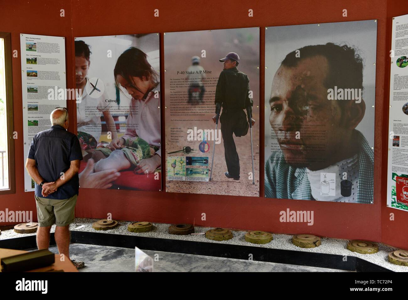 Cambodia landmine museum hi-res stock photography and images - Alamy