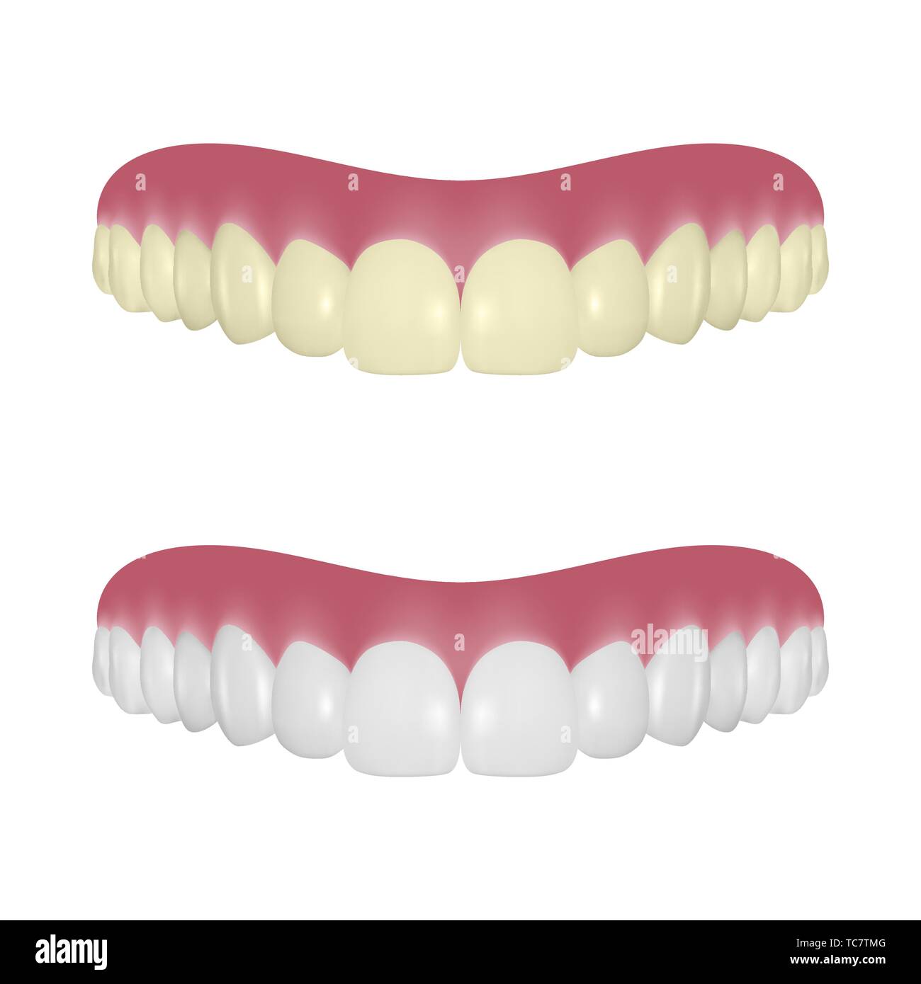 3d open denture isolated on hi-res stock photography and images - Alamy