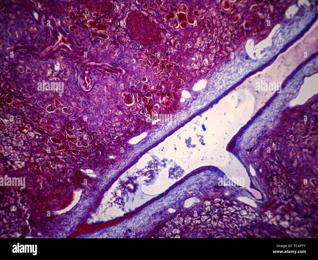 Symptoms Of Lung Worms In Cattle at Lon Taylor blog