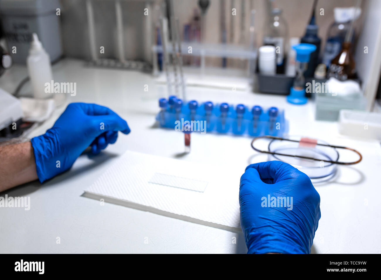 scientist prepare blood sample for research on microscope. Placing ...