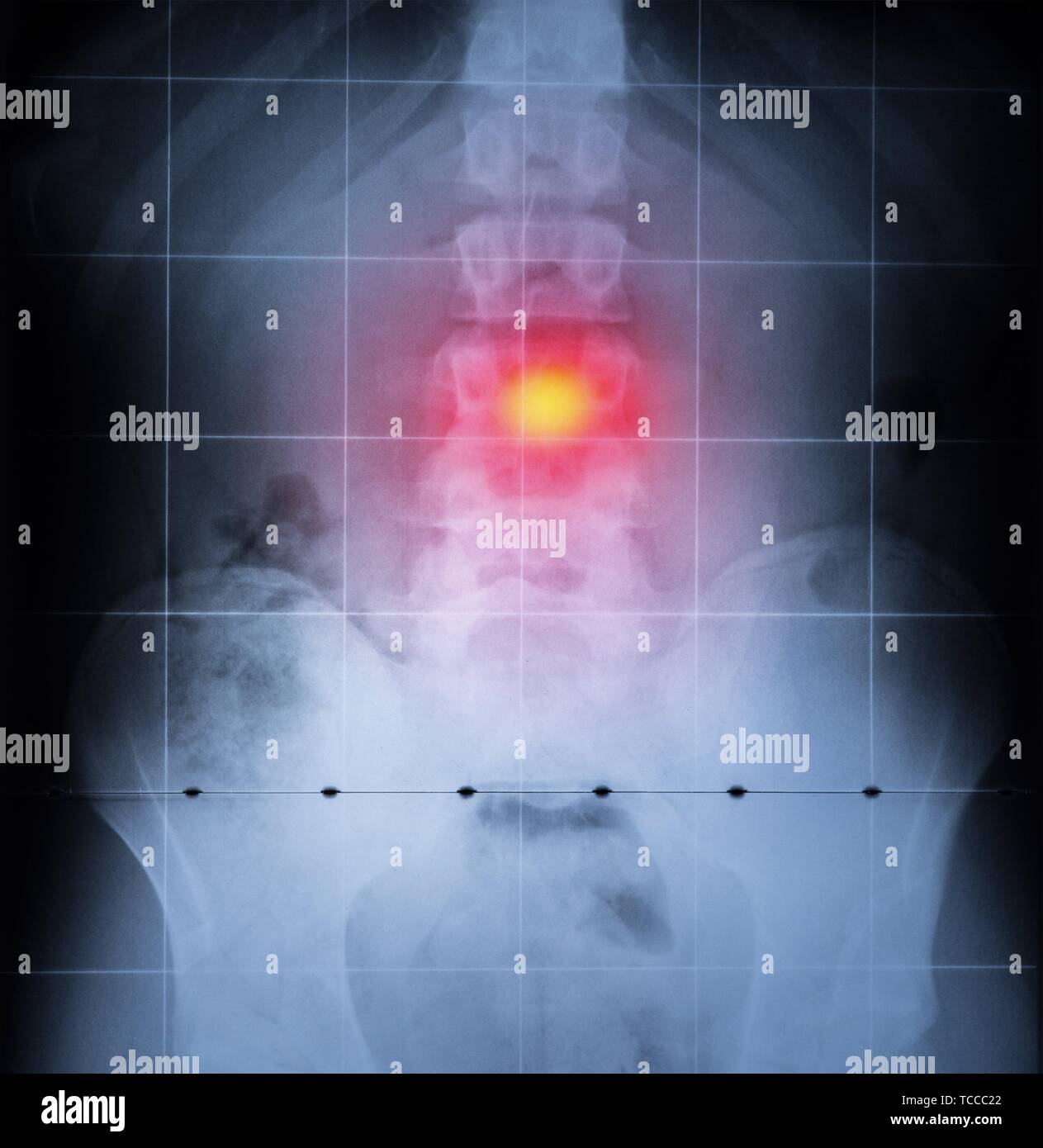 Back pain doctor hi-res stock photography and images - Alamy