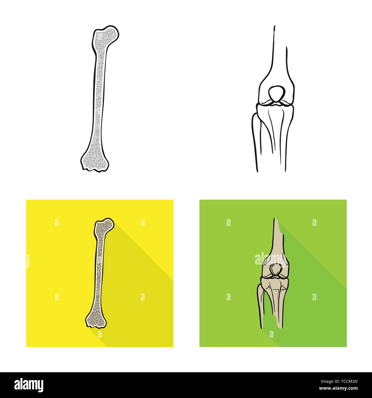 femur,bony,leg,knee,tibia,fibula,alignment,joint,movement,injury ...