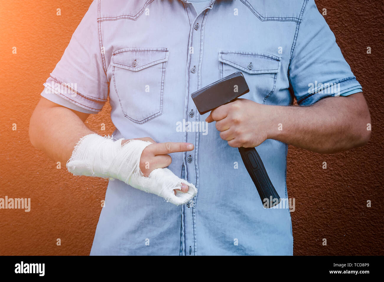 hand in plaster from a blow with a hammer Stock Photo - Alamy