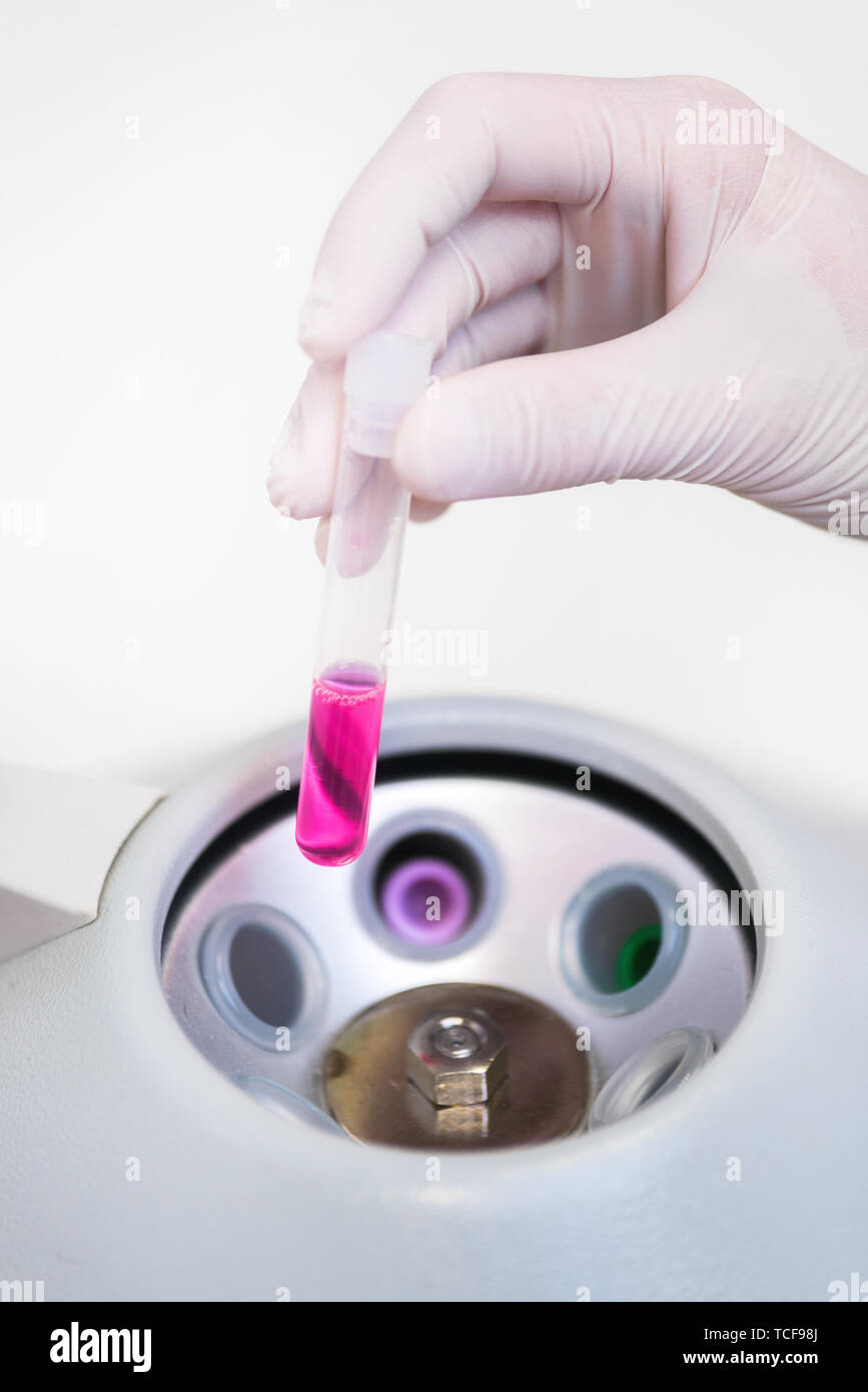 Centrifuge sample hi-res stock photography and images - Alamy